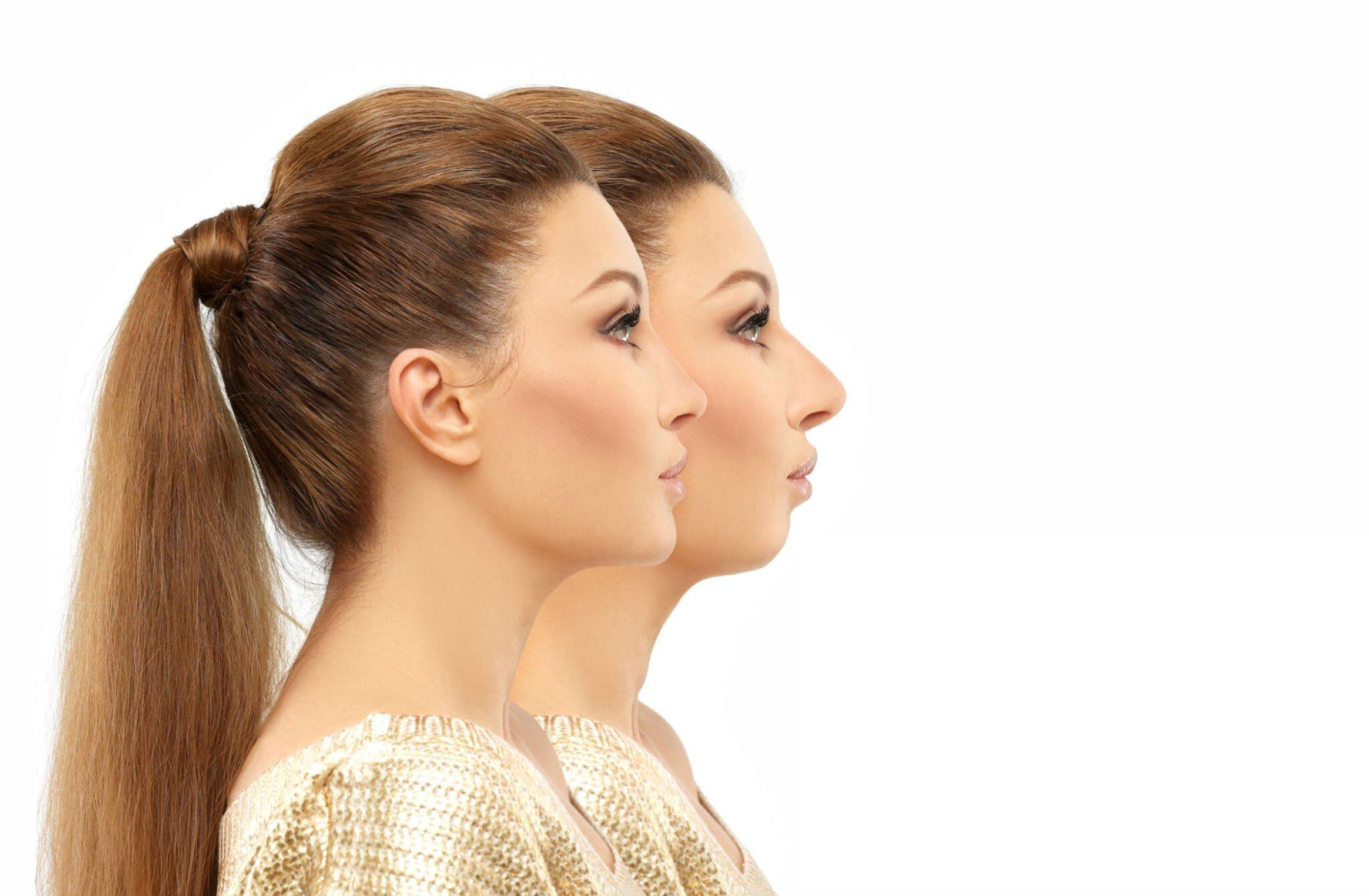 Genioplasty surgery - Ibdaa Dental Clinic